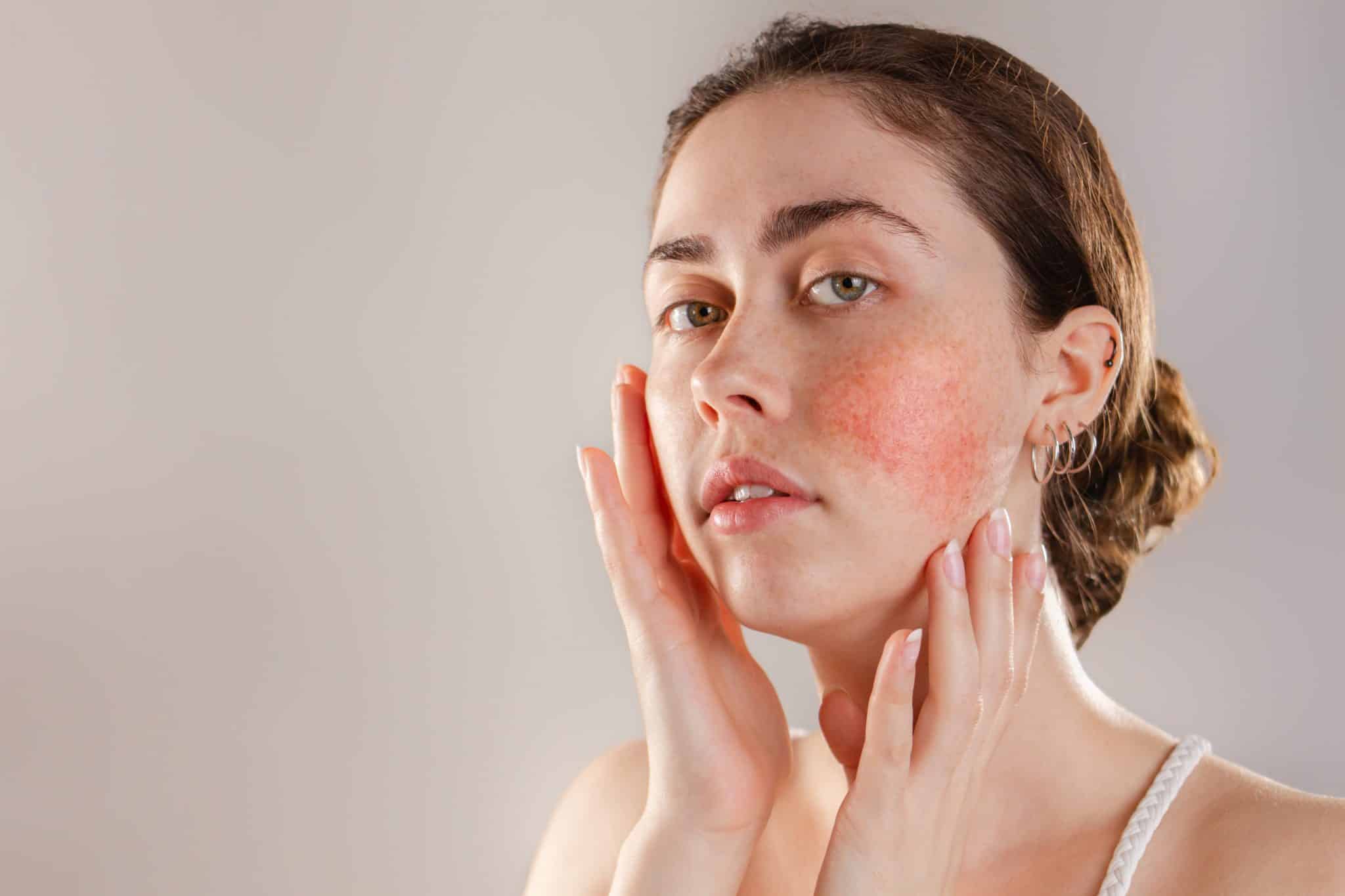 Probleme de peau : 3 conditions fréquentes et comment les régler | Bizzbook